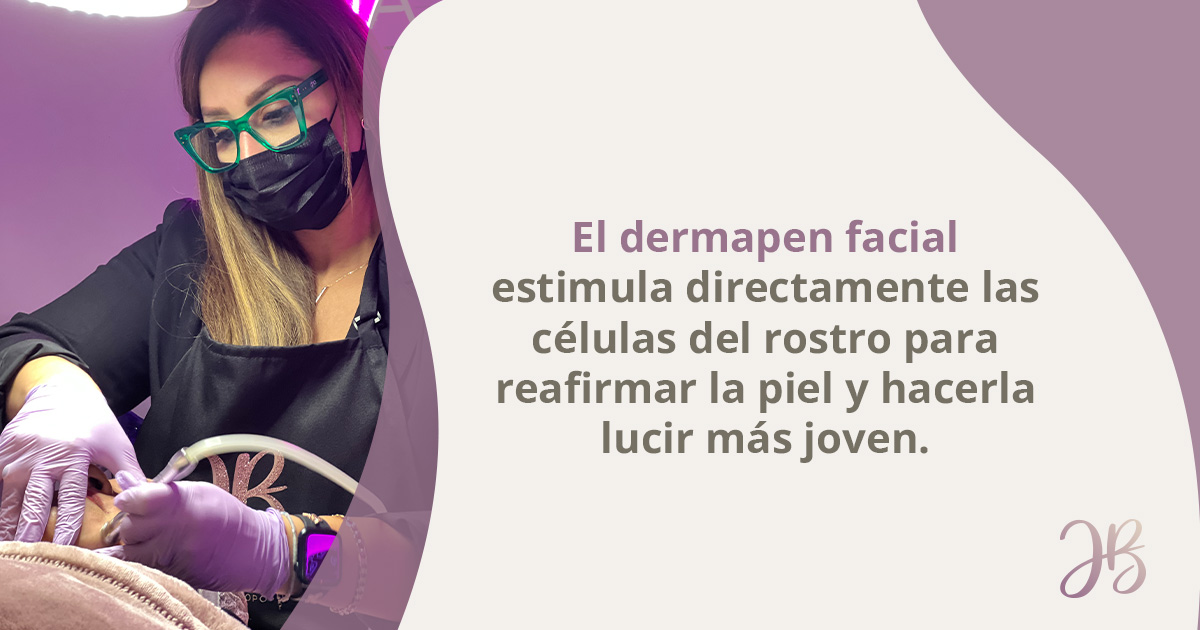 ¿Cómo Funciona el Dermapen Facial?
